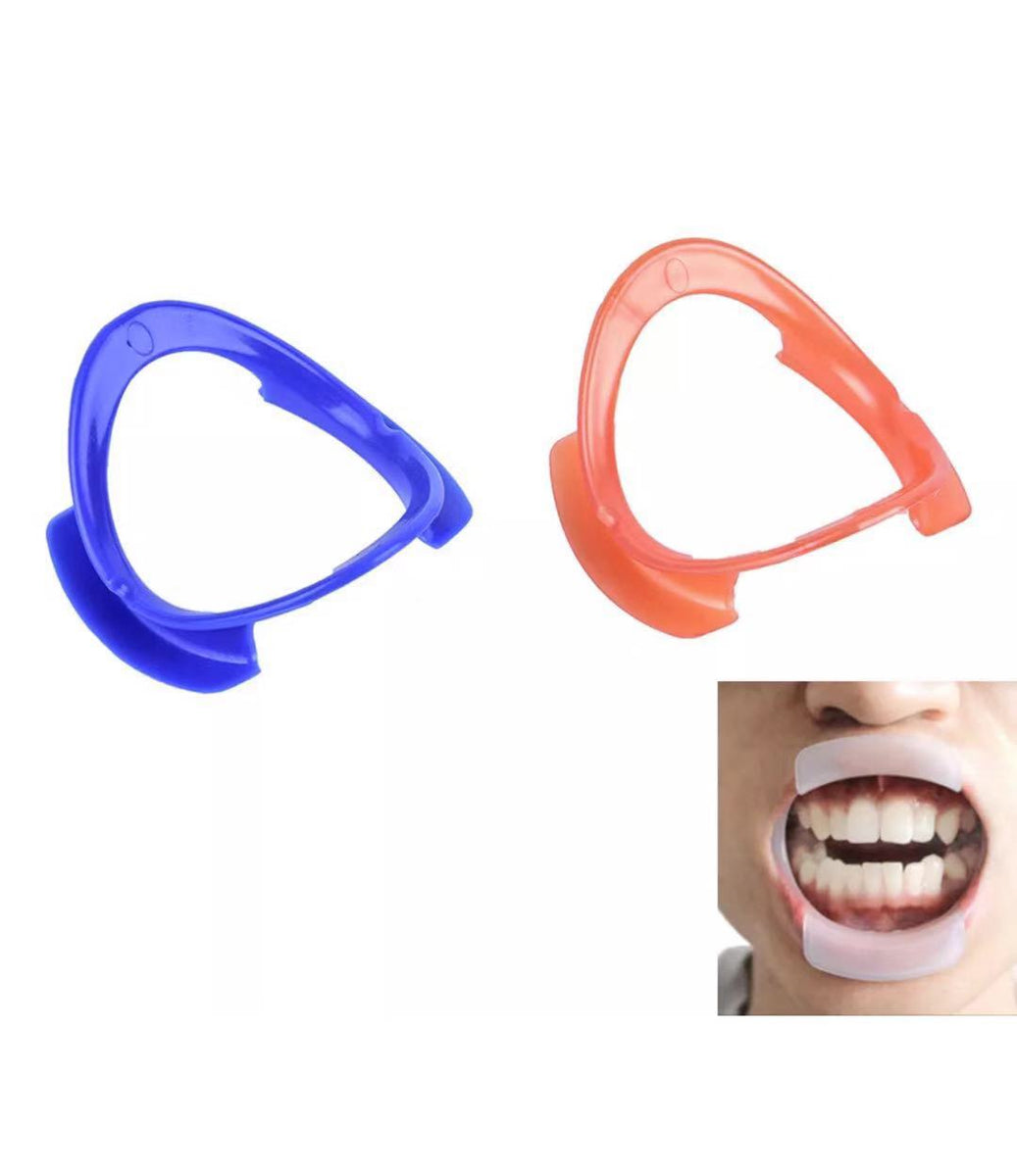 Dental Cheek Retractor Lip Ring Retractor Mouth Opener – LJ Healthcare